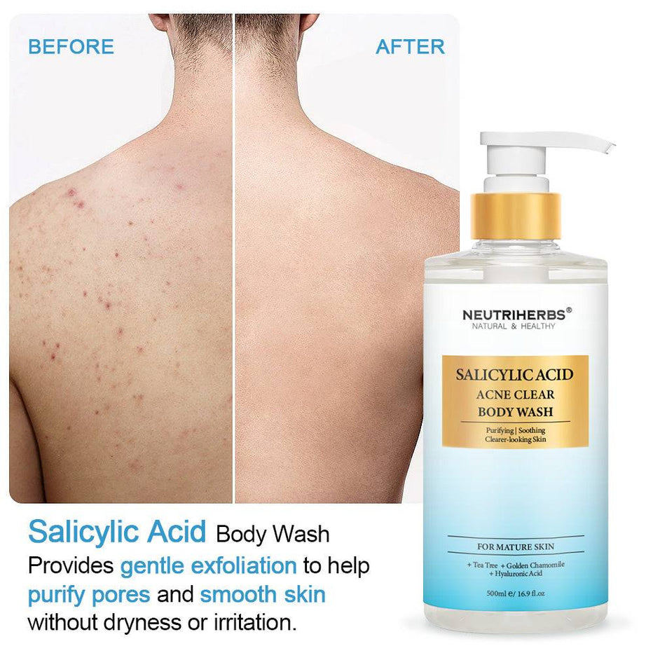 Acne Clear Salicylic Acid Body Wash – Neutriherbs