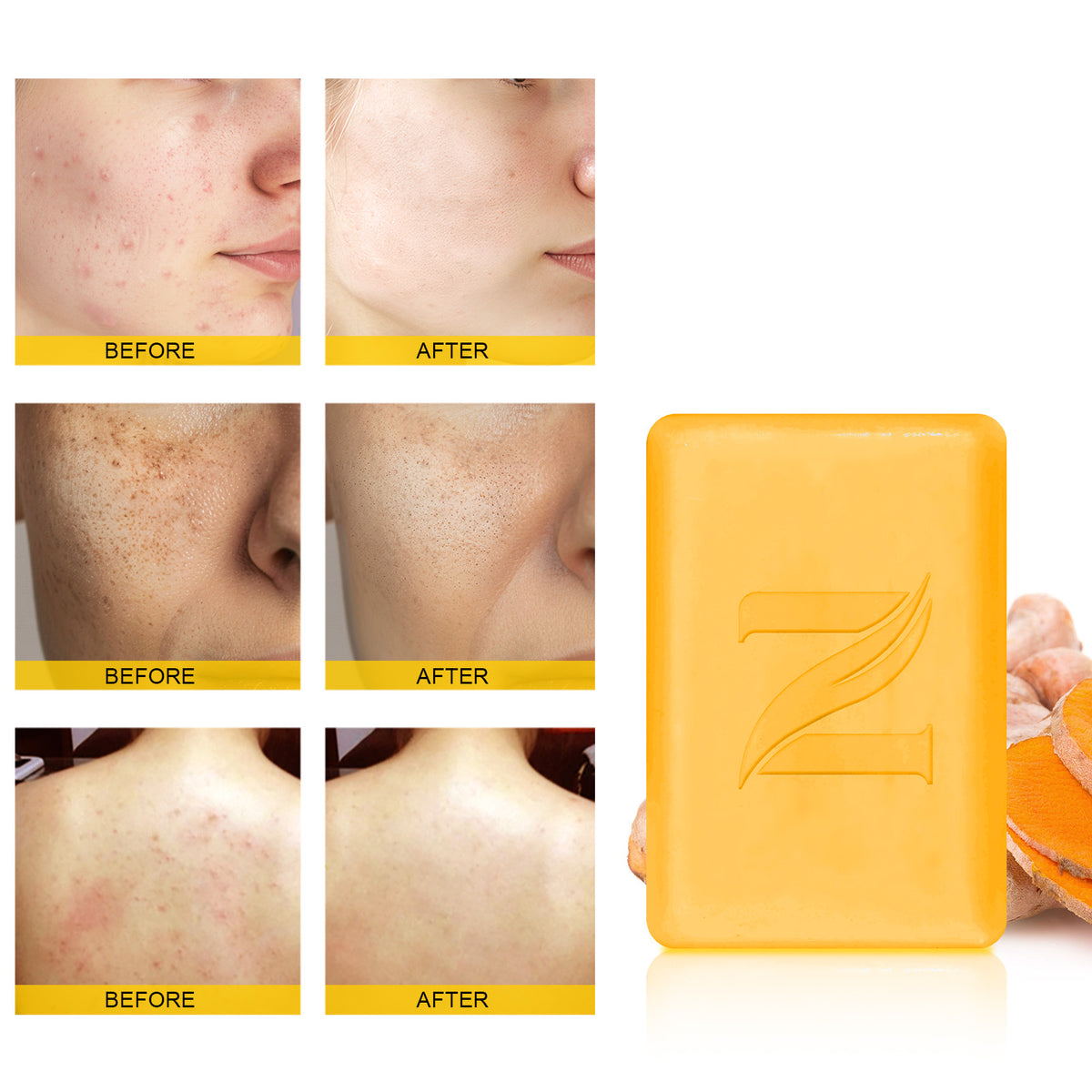 Best Vitamin C Turmeric Soap For Black Skin Even Skin Tone – Neutriherbs