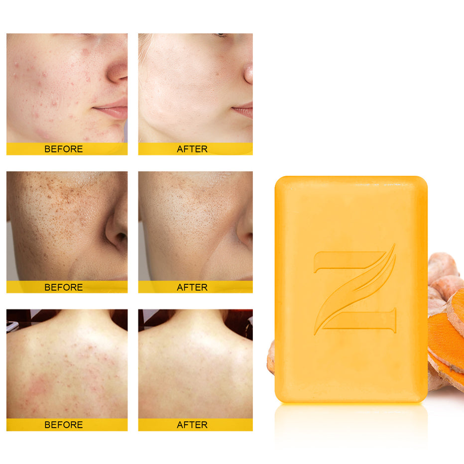 Best Vitamin C Turmeric Soap For Black Skin Even Skin Tone – Neutriherbs